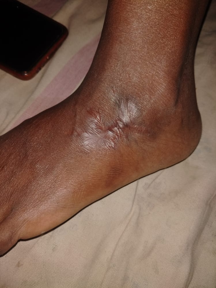 The supreme healing therapy is friendship and love – JPIC